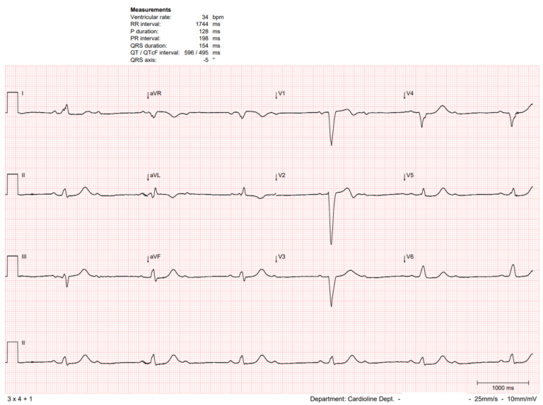 ECG Downloads - Ambulatory ECG Holter monitoring - ECG On-Demand